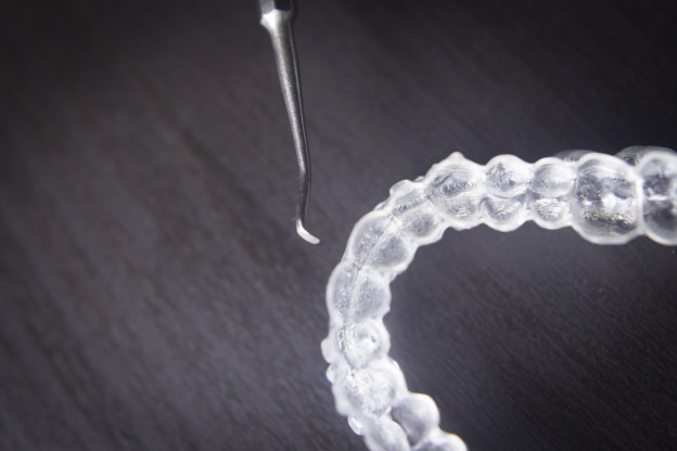 Inman Aligner UK vs Invisalign Braces – The changing Face Of Braces | Blog
