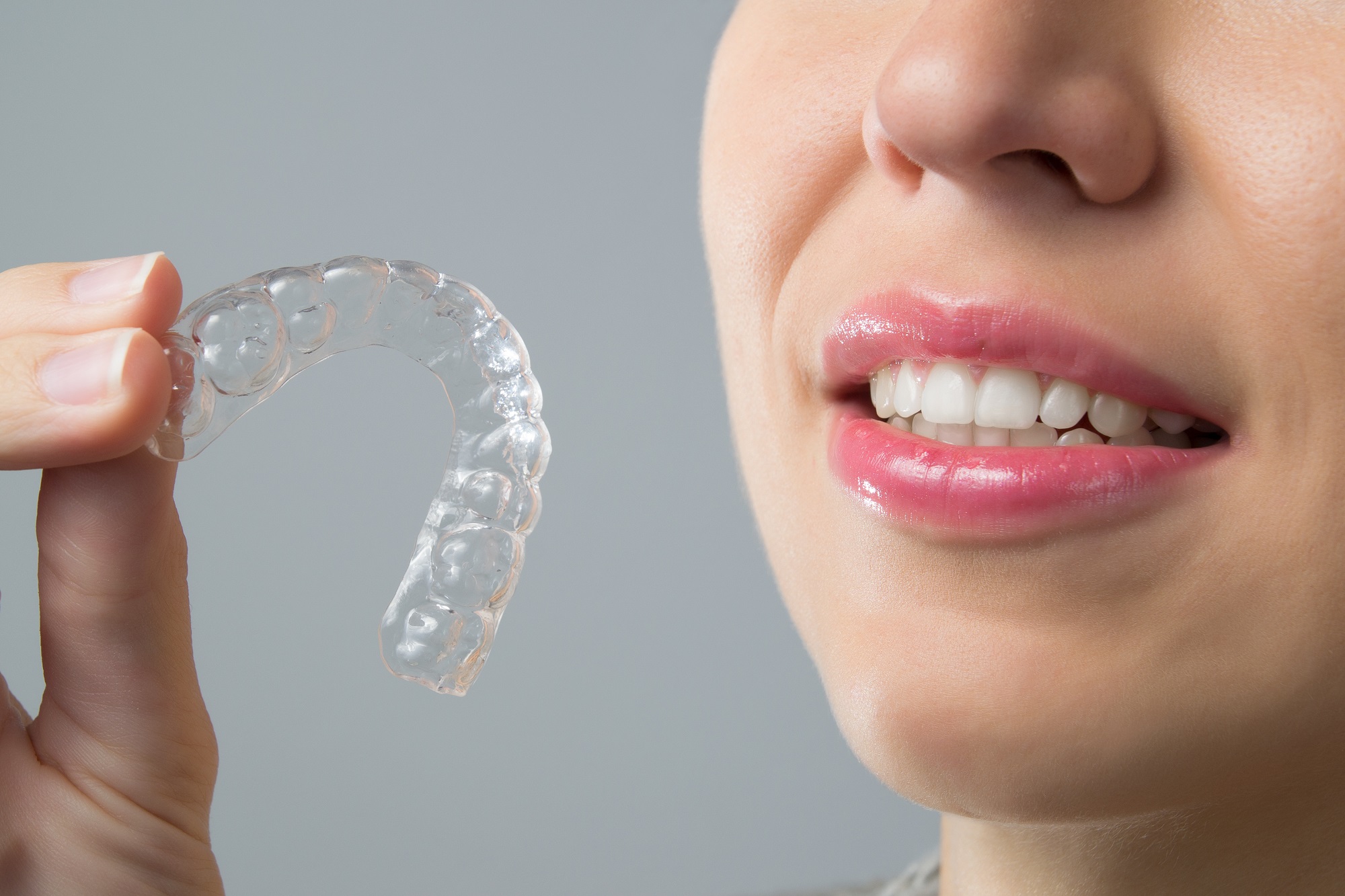 Clear View Braces - What Are They and How Do They Work? | Blog